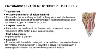 Paedo Lecture - Trauma to Anterior Teeth in Children.pdf