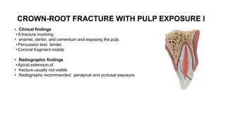 Paedo Lecture - Trauma to Anterior Teeth in Children.pdf