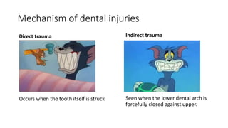 Paedo Lecture - Trauma to Anterior Teeth in Children.pdf