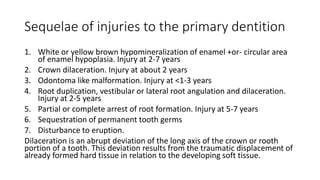 Paedo Lecture - Trauma to Anterior Teeth in Children.pdf