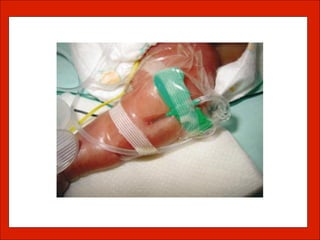 Paed resus in_retrieval.key