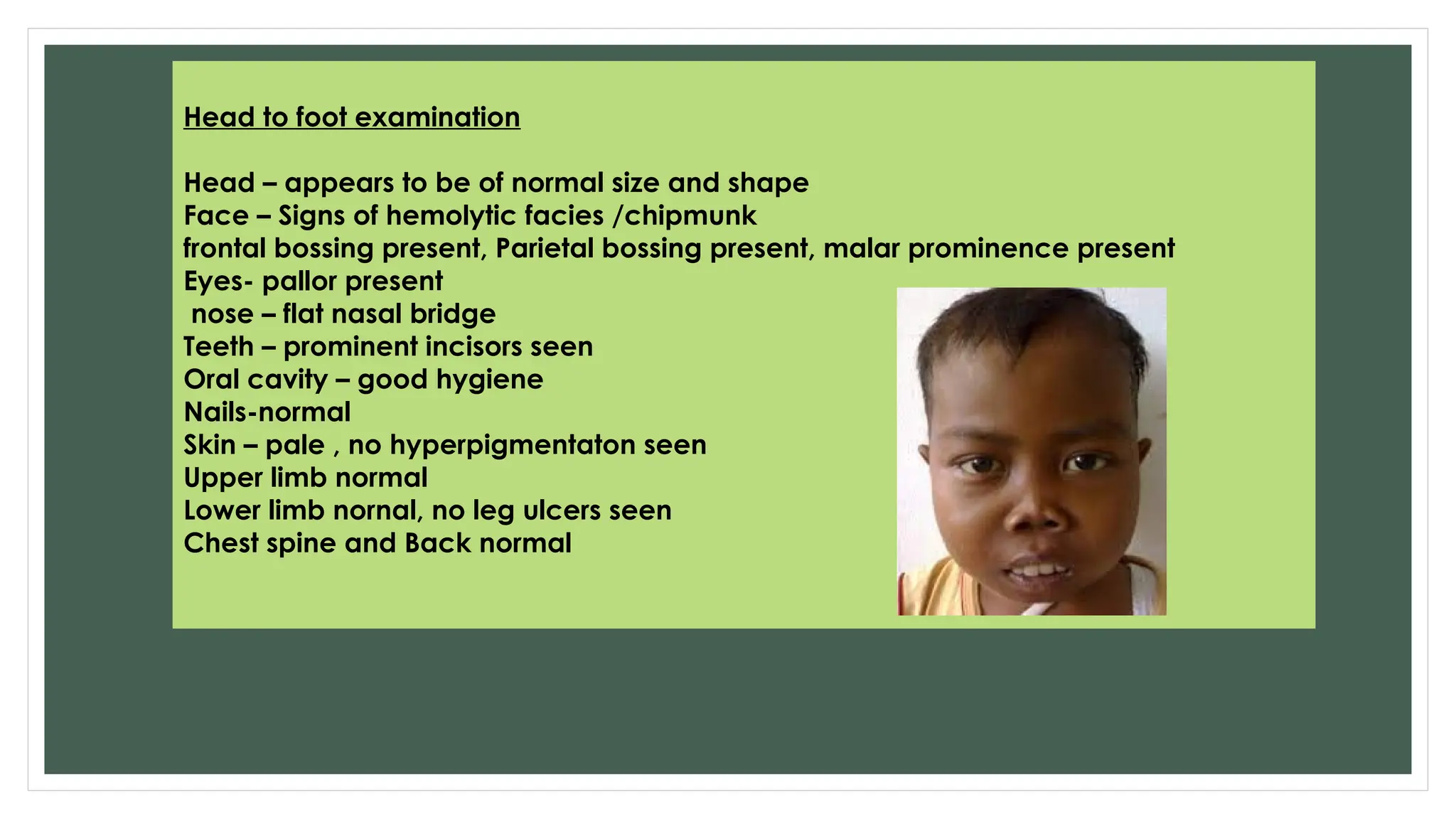 Case presentation on -thalassemia case.pptx