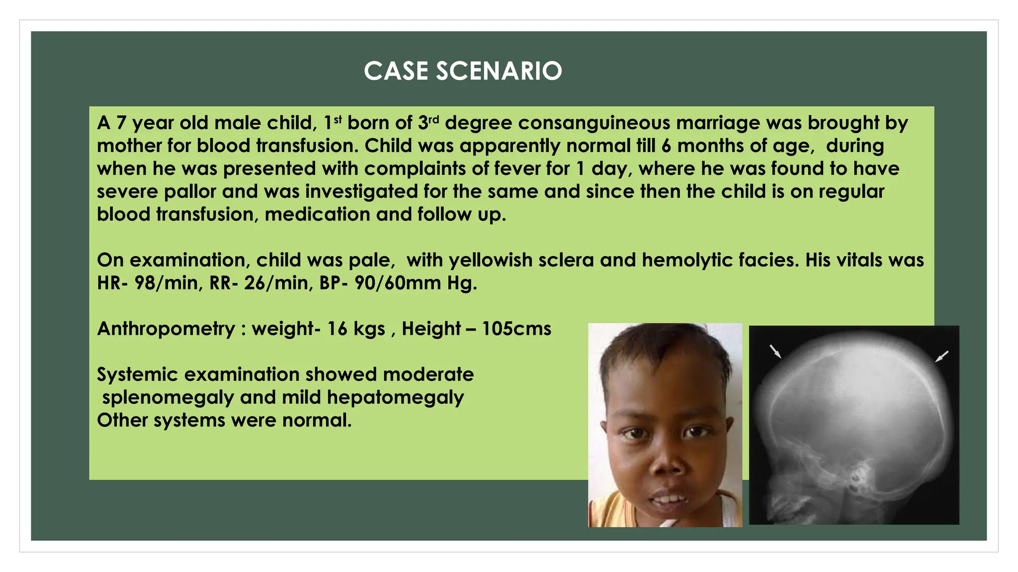 Case presentation on -thalassemia case.pptx