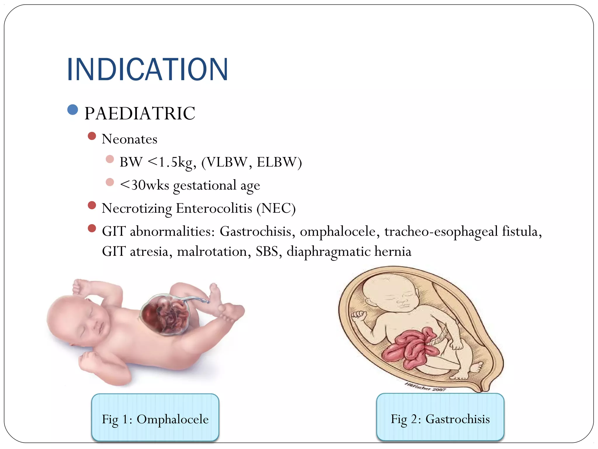 Pediatric Parenteral Nutrition | PPT