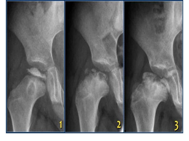 paeds radiology 1.pptx