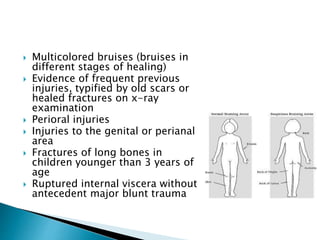 Paeds trauma dayang | PPT