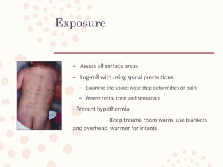 paediatrics trauma management in emenrgency | PPTX