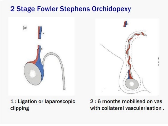 Paediatric Urology [Dr.Edmond Wong]