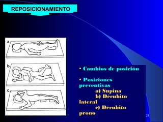 PAE Úlceras por Decúbito | PPT