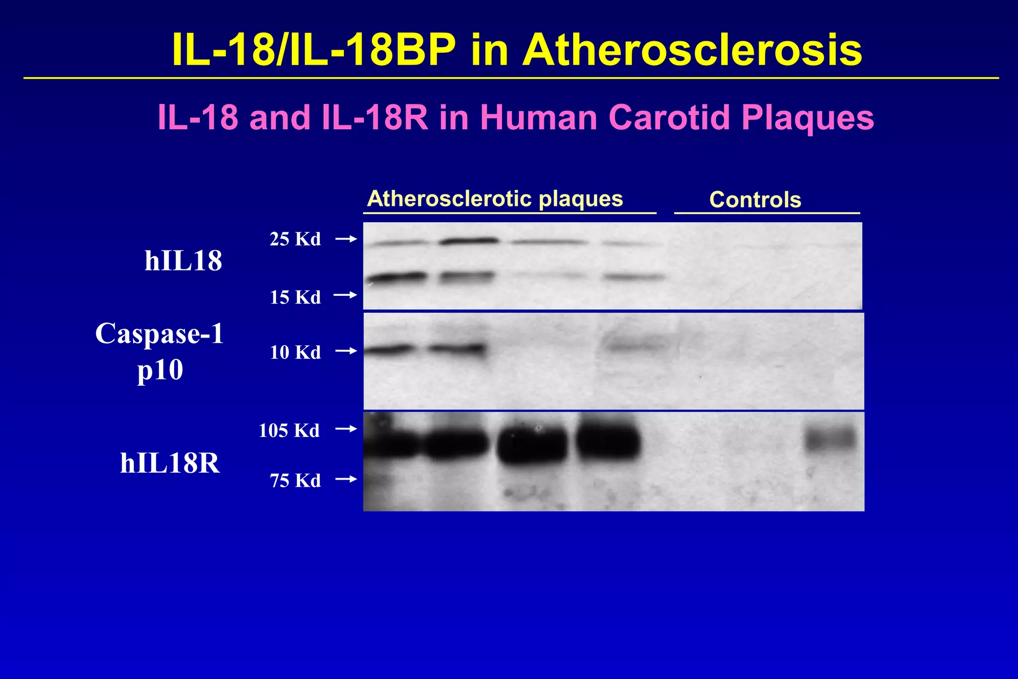 092 il18 and il18 bp in atherosclerosis | PPT