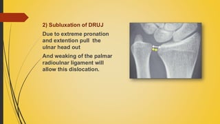 page2-21.pdf, radioulnar joint in human anatomy | PDF