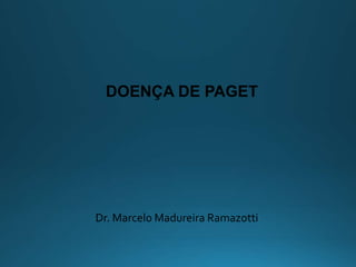 Doença de Paget | PPTX