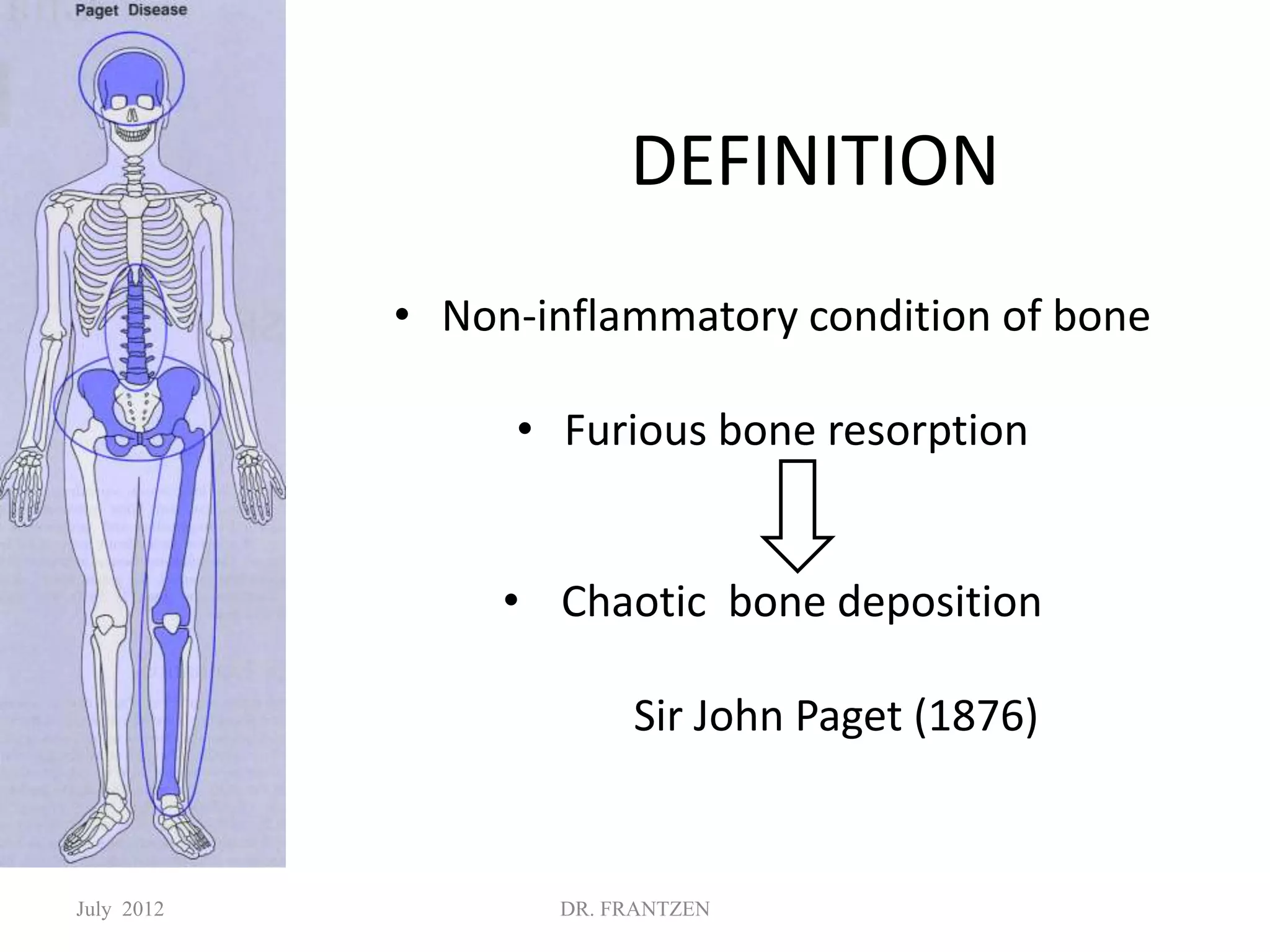 Paget disease .ppt