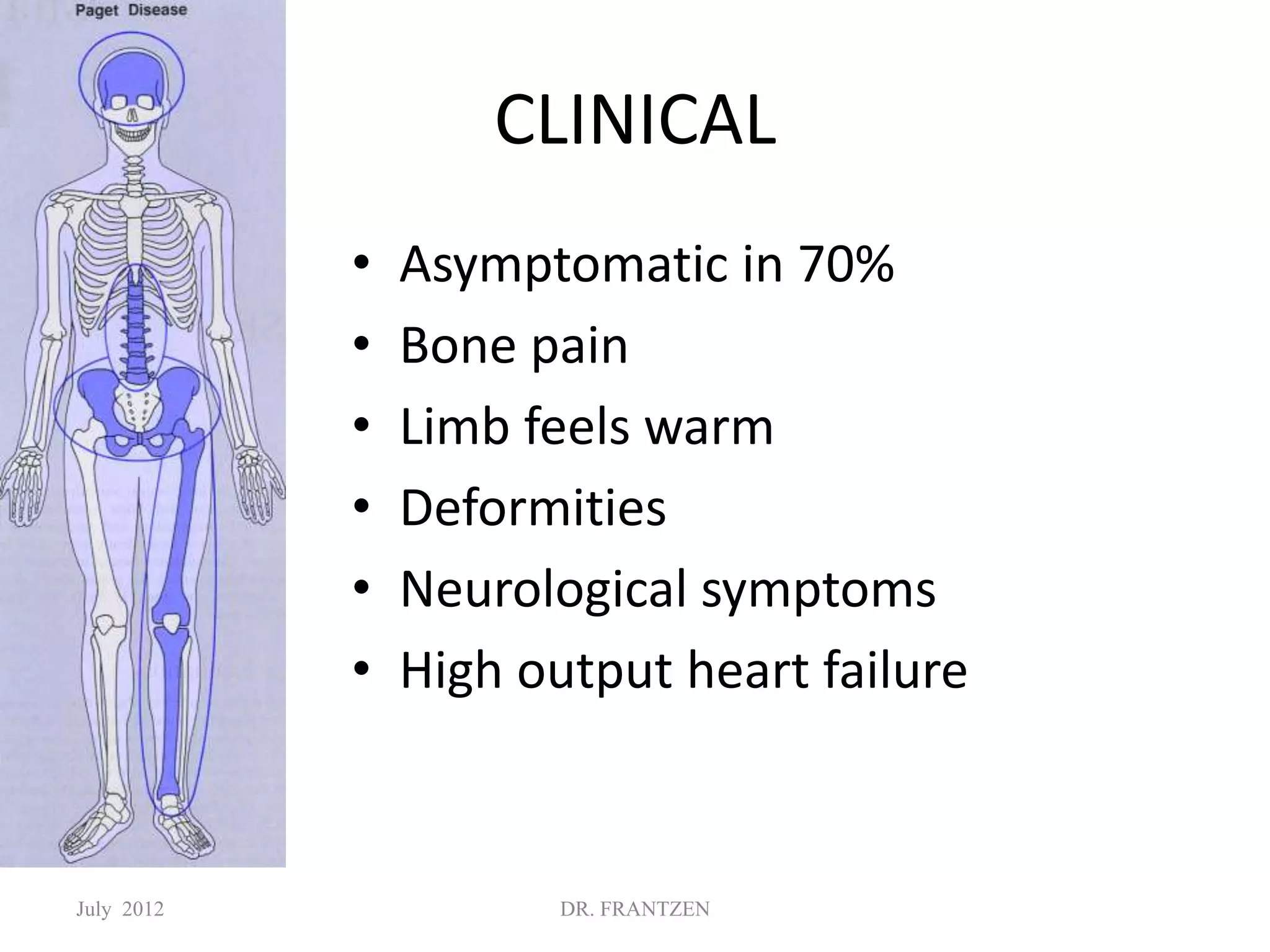 Paget disease .ppt
