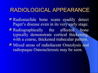 paget's disease | PPT