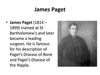 Paget's disease of bone - | PPTX