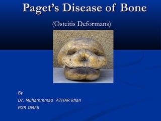 Pagets disease-of-bone-by dr.athar | PPT