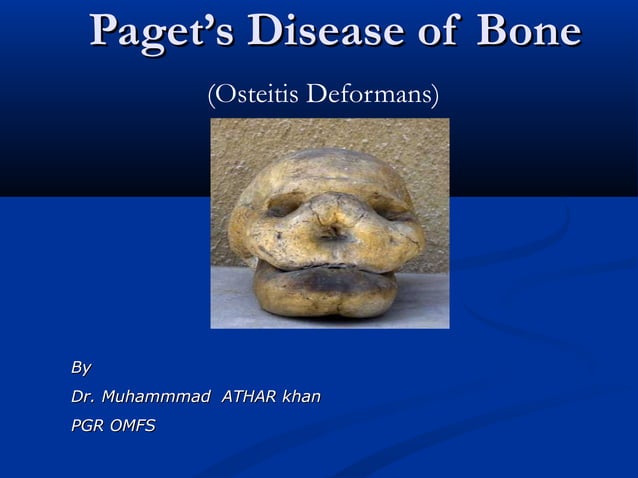 Pagets disease-of-bone-by dr.athar | PPT