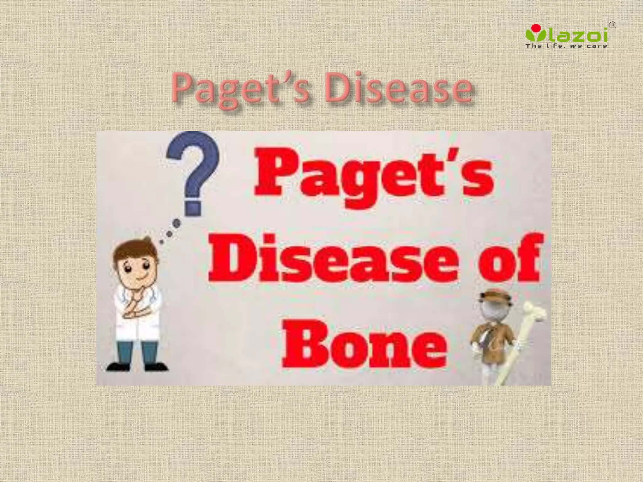 Paget’s disease | PPTX