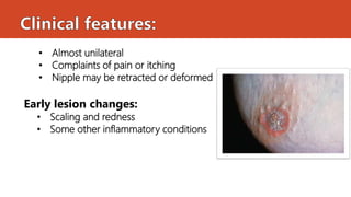 Paget's disease | PPTX