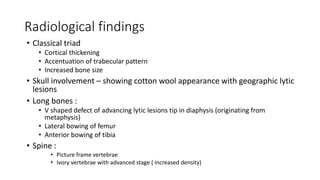 Paget's disease | PPTX