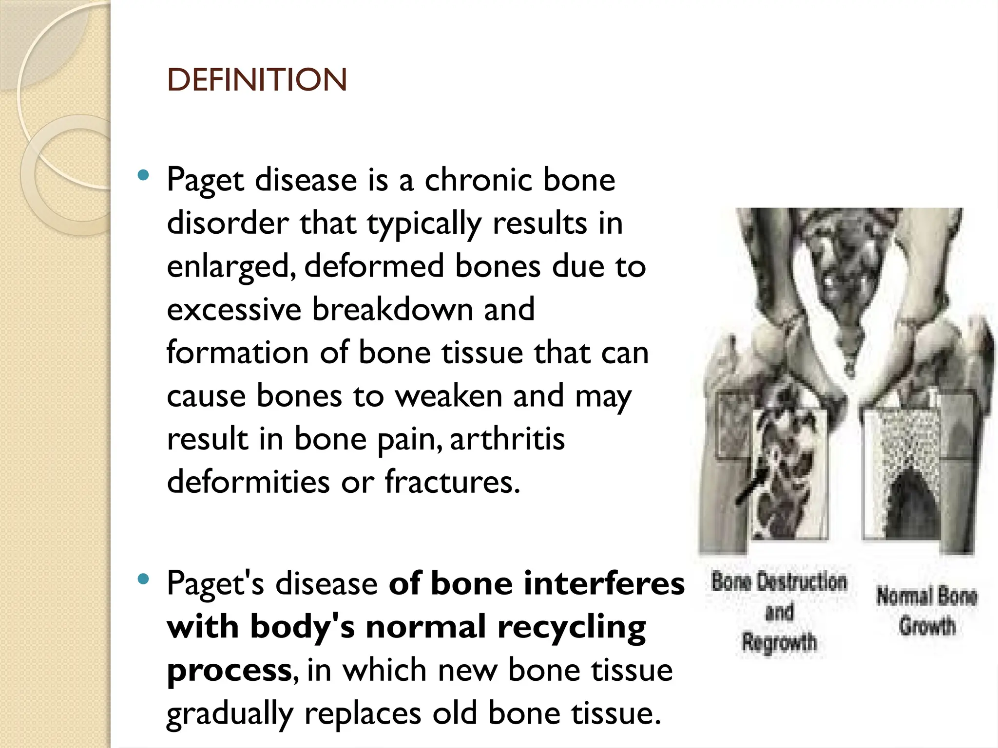 PAGET'S DISEASE (2).pptx lecture slide for Bachelor of Nursing | PPTX