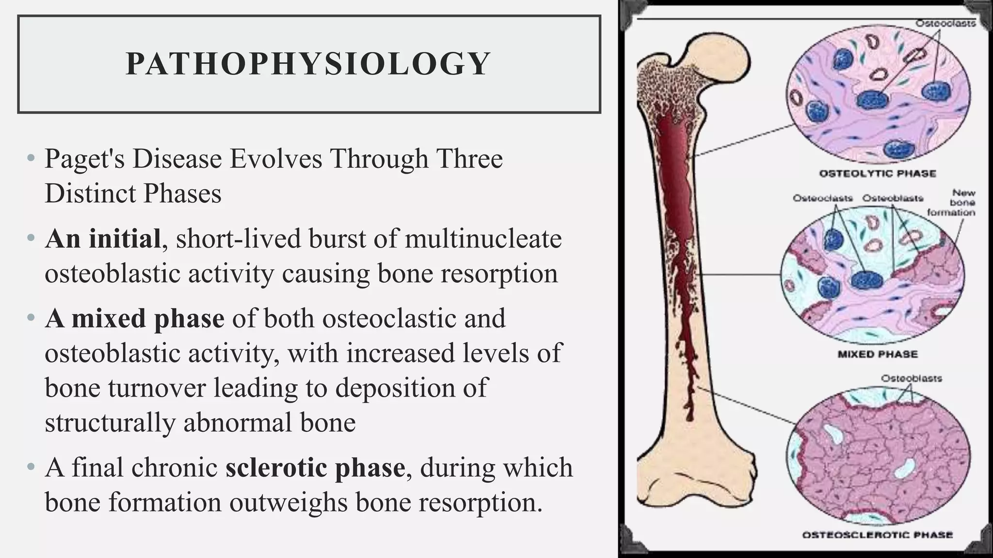 PAGET’S DISEASE ppt.pptx
