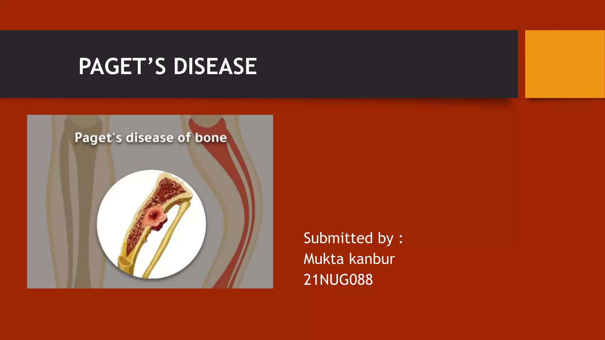 paget's disease | PPTX