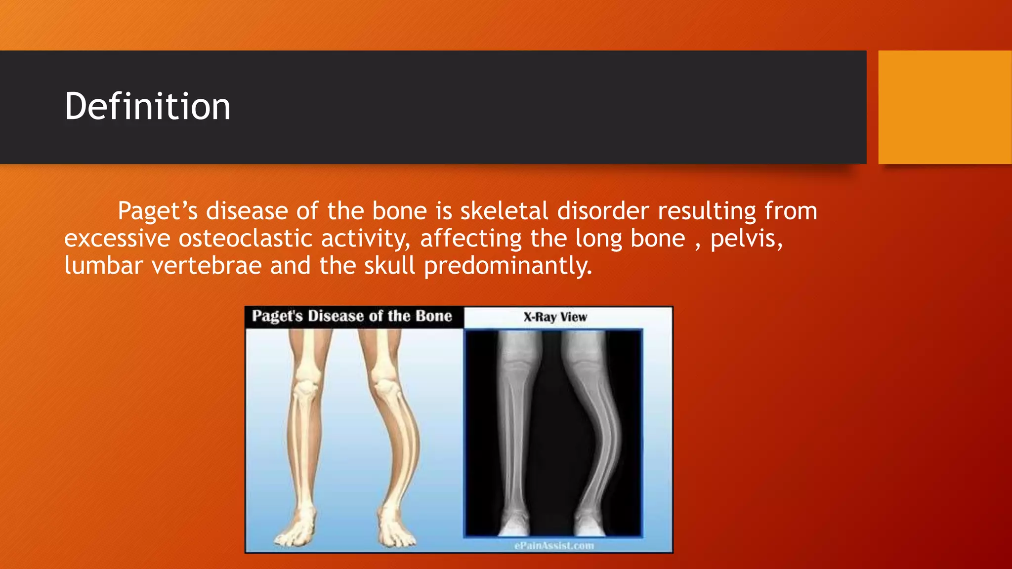 paget's disease | PPTX