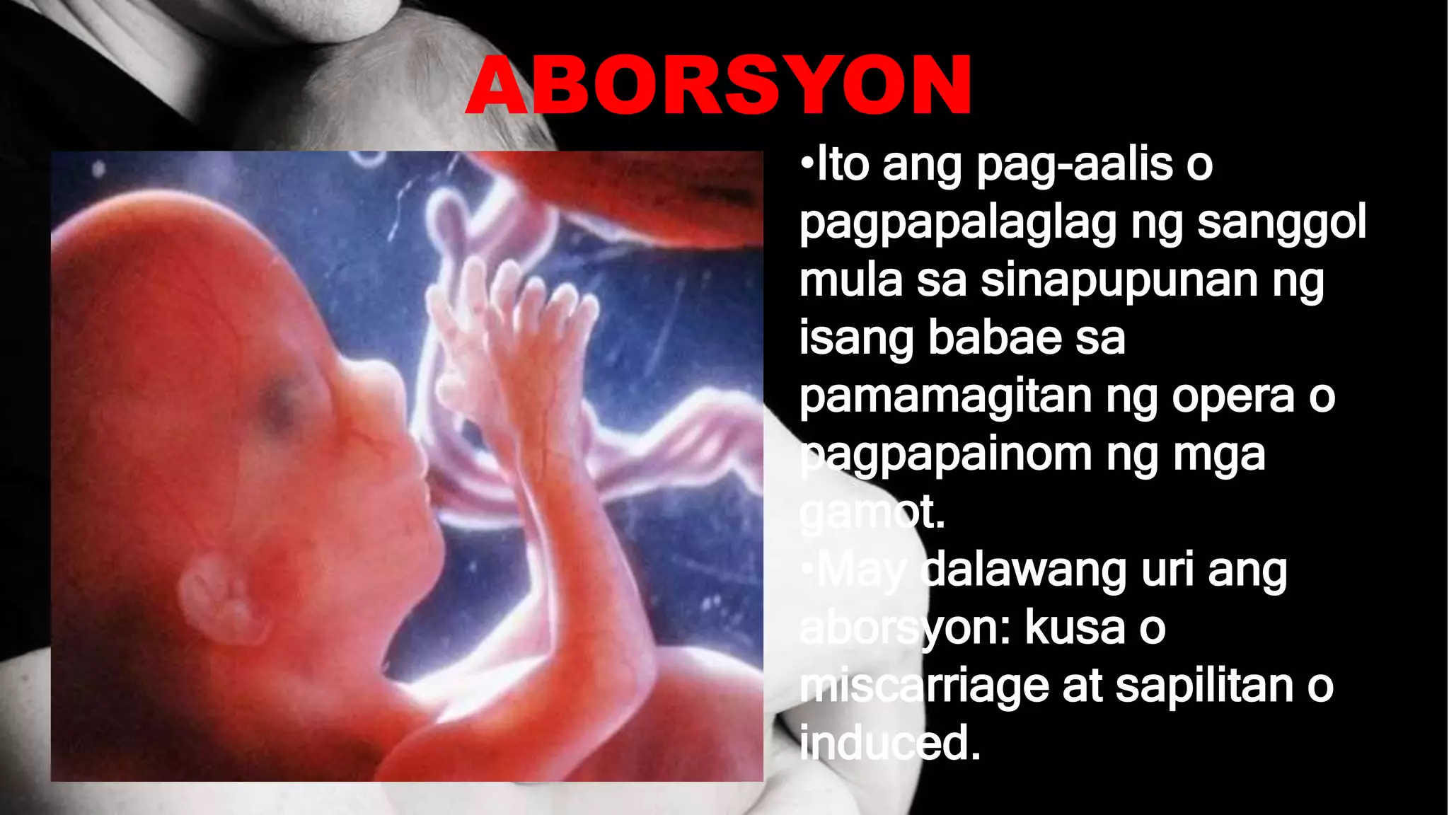 Paggalang sa Buhay | PPTX