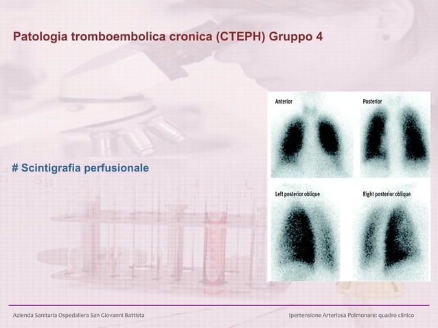 Clinica Ipertensione Polmonare Arteriosa-PAH CLINICAL | PPT