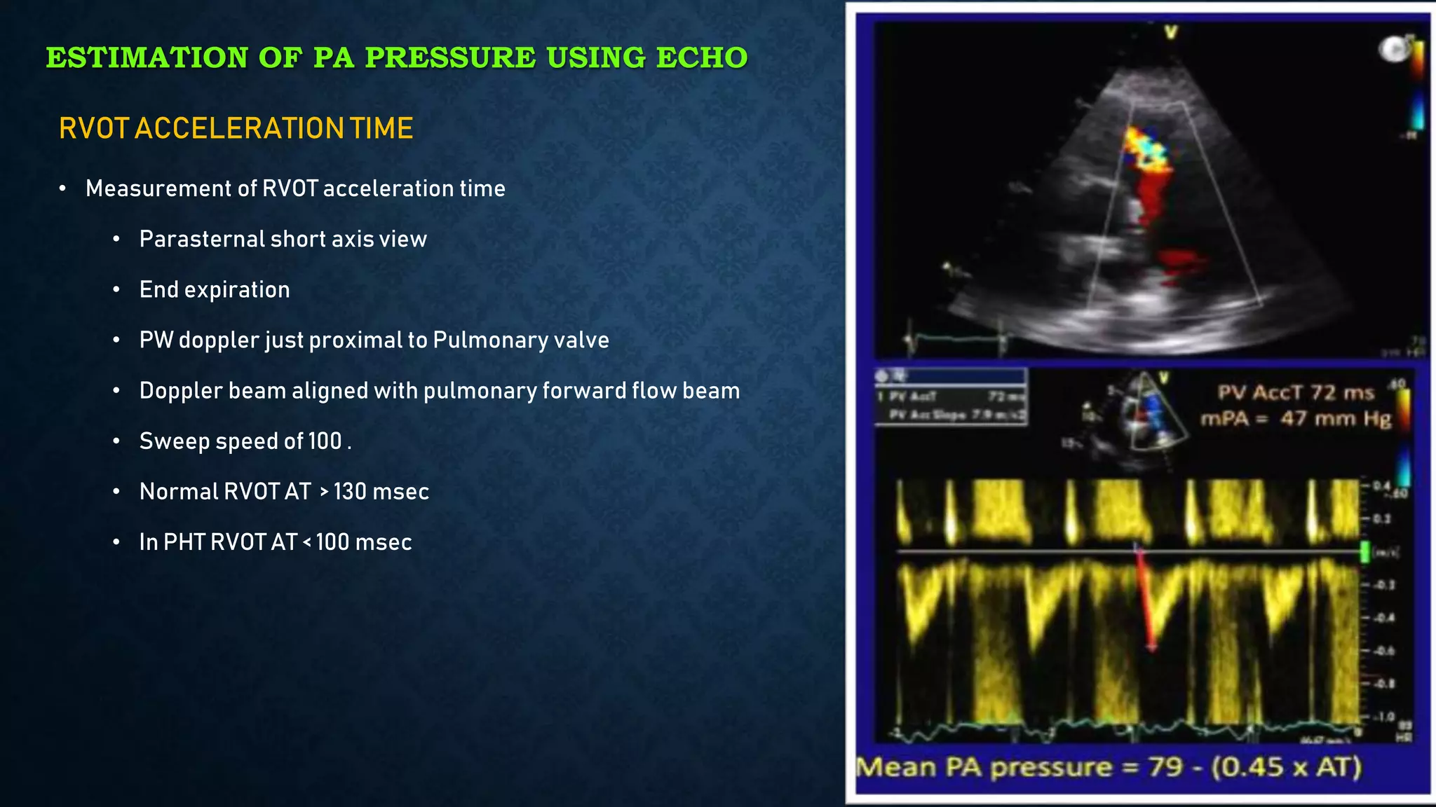 PAH echo - dr abhishek.pptx