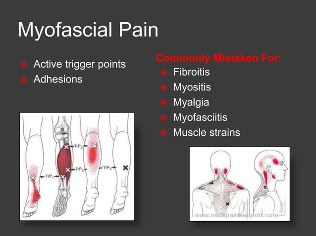 Uncovering Pain: The physiological and psychological components of pain ...