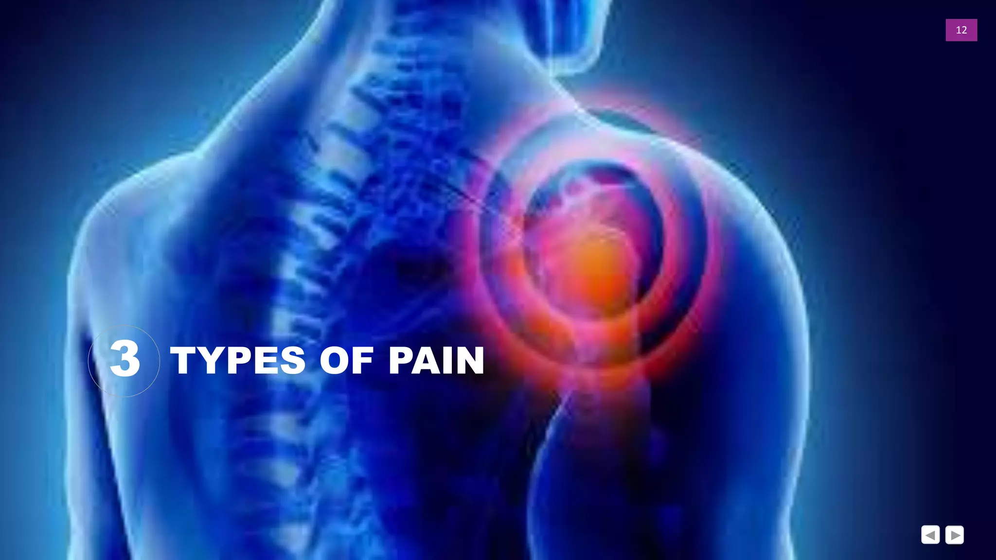 Pain Management | PPTX