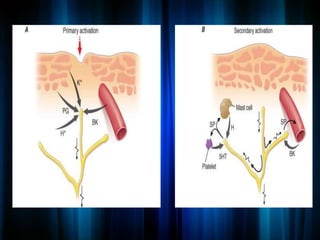 Pain multidisciplinary approach | PPTX