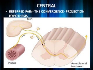 Pain multidisciplinary approach | PPTX
