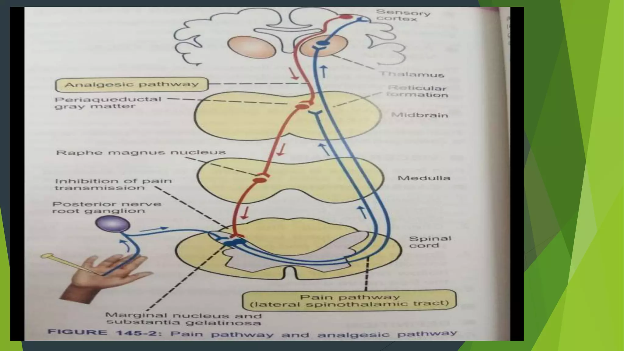 Pain definition, pathway,analgesic pathway, types of pain | PPTX