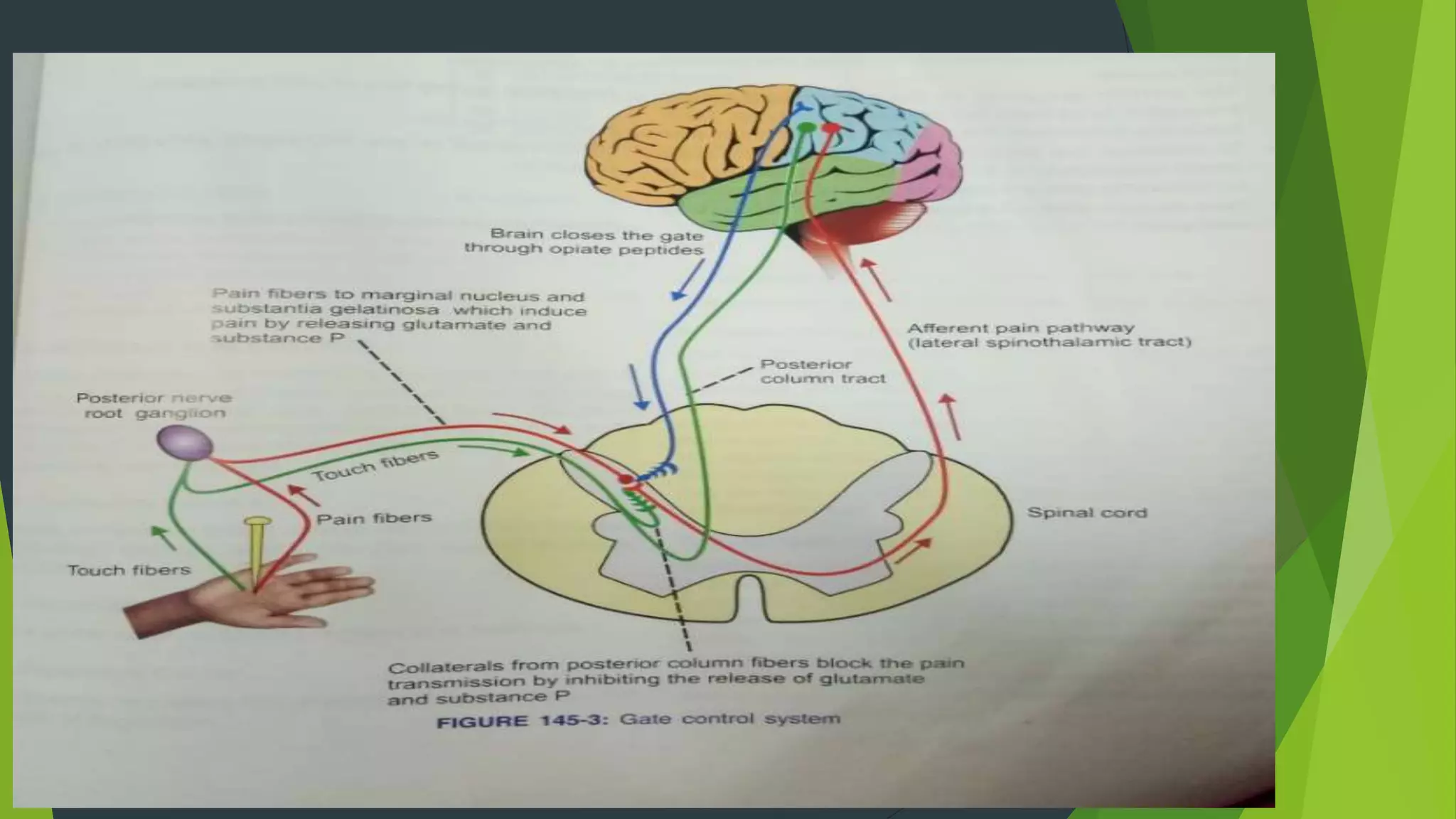 Pain definition, pathway,analgesic pathway, types of pain | PPTX