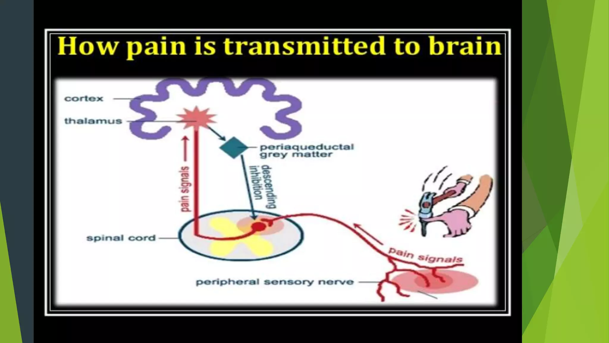 Pain definition, pathway,analgesic pathway | PPTX