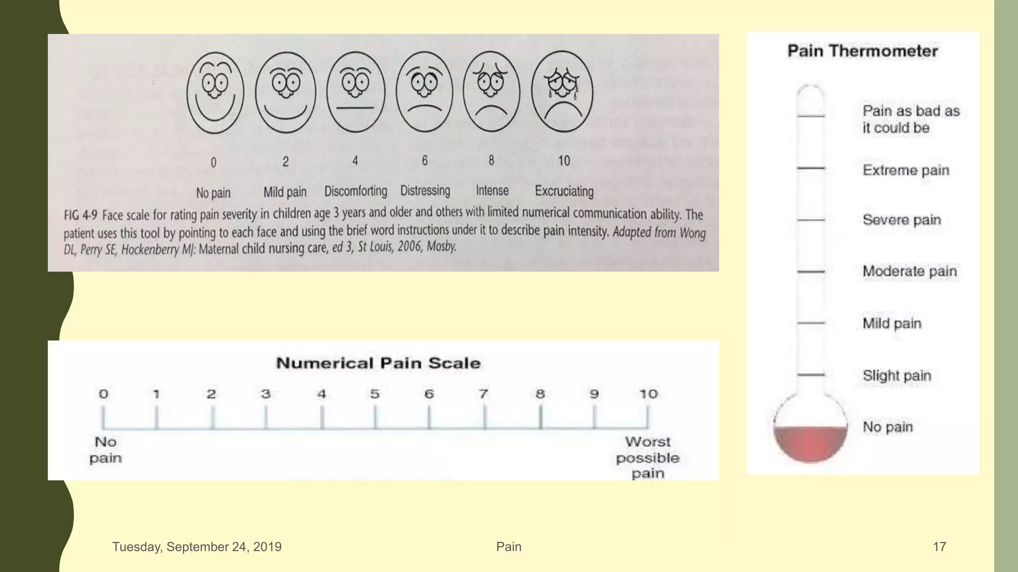 Pain : definition, assessment, types, scales, physiotherapy management ...
