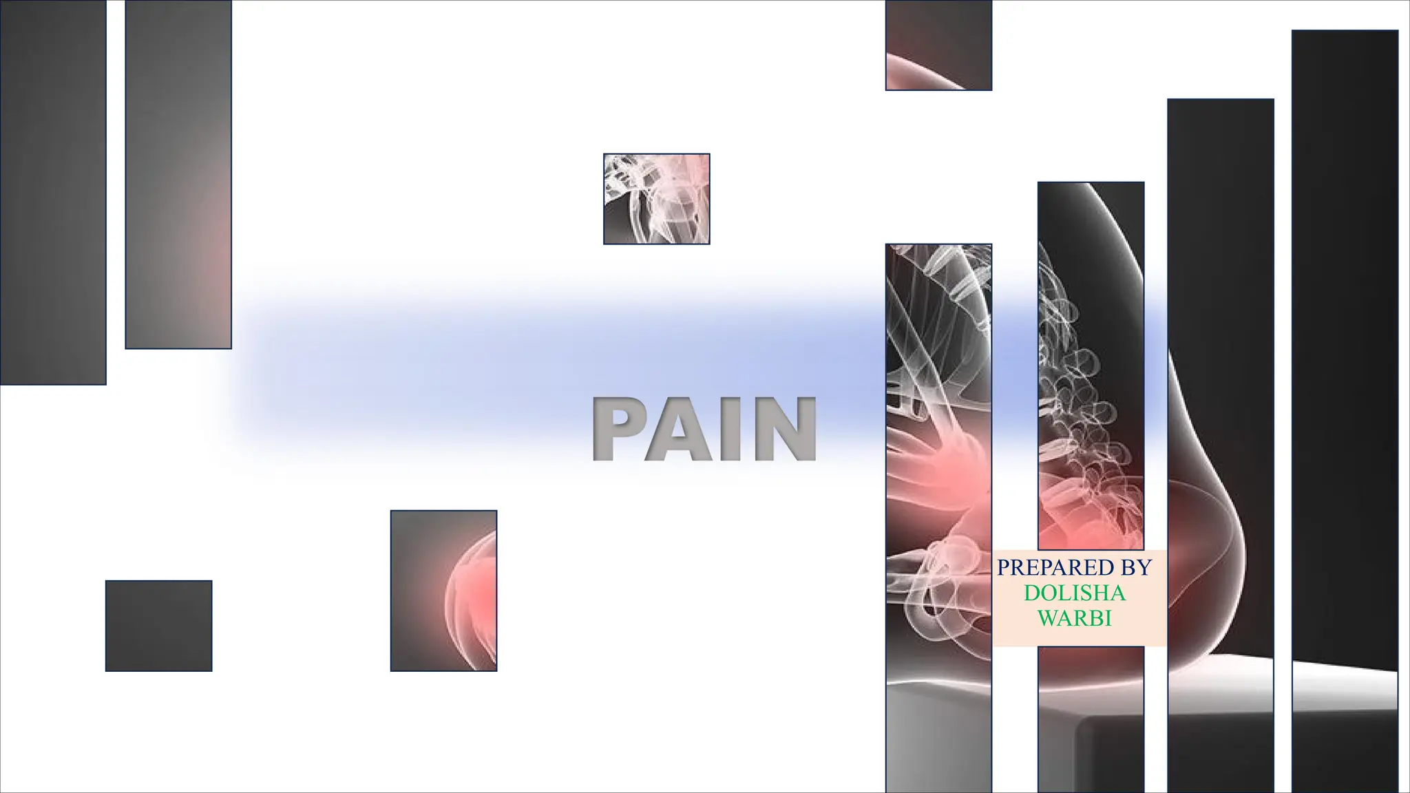 PAIN/CLASSIFICATION AND MANAGEMENT OF PAIN.pdf