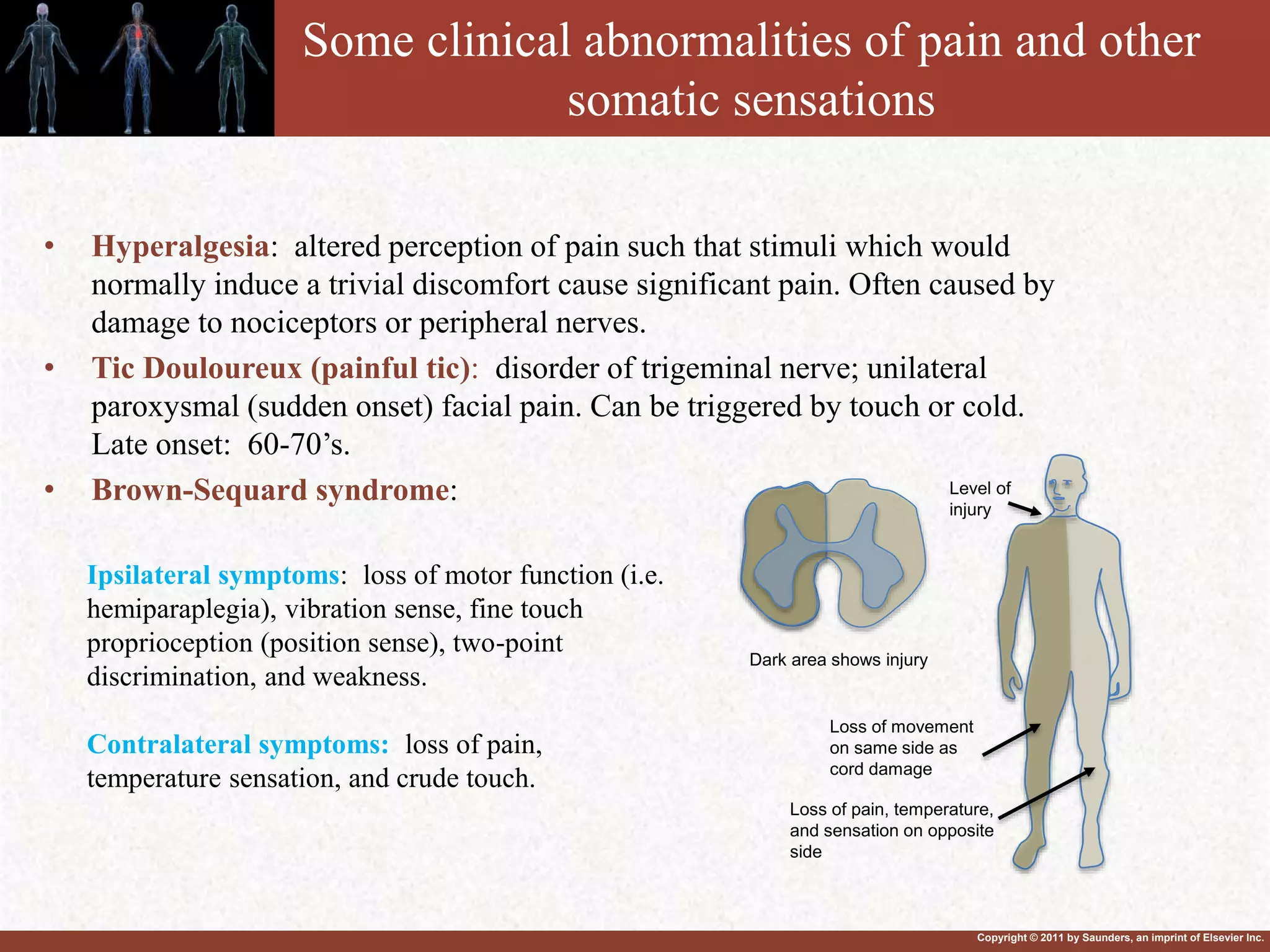Pain and thermal sensations | PPT