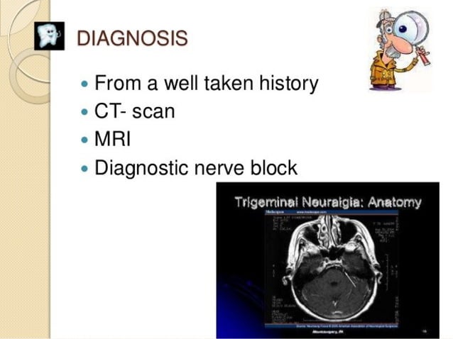 Pain and Trigeminal neuralgia.pptx . | PPT