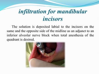 pain control for child and adolescent.pptx