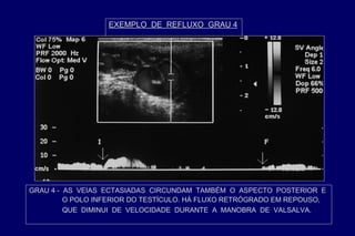 Painel digital varicocele - Aula do Dr Décio Prando - | PPT