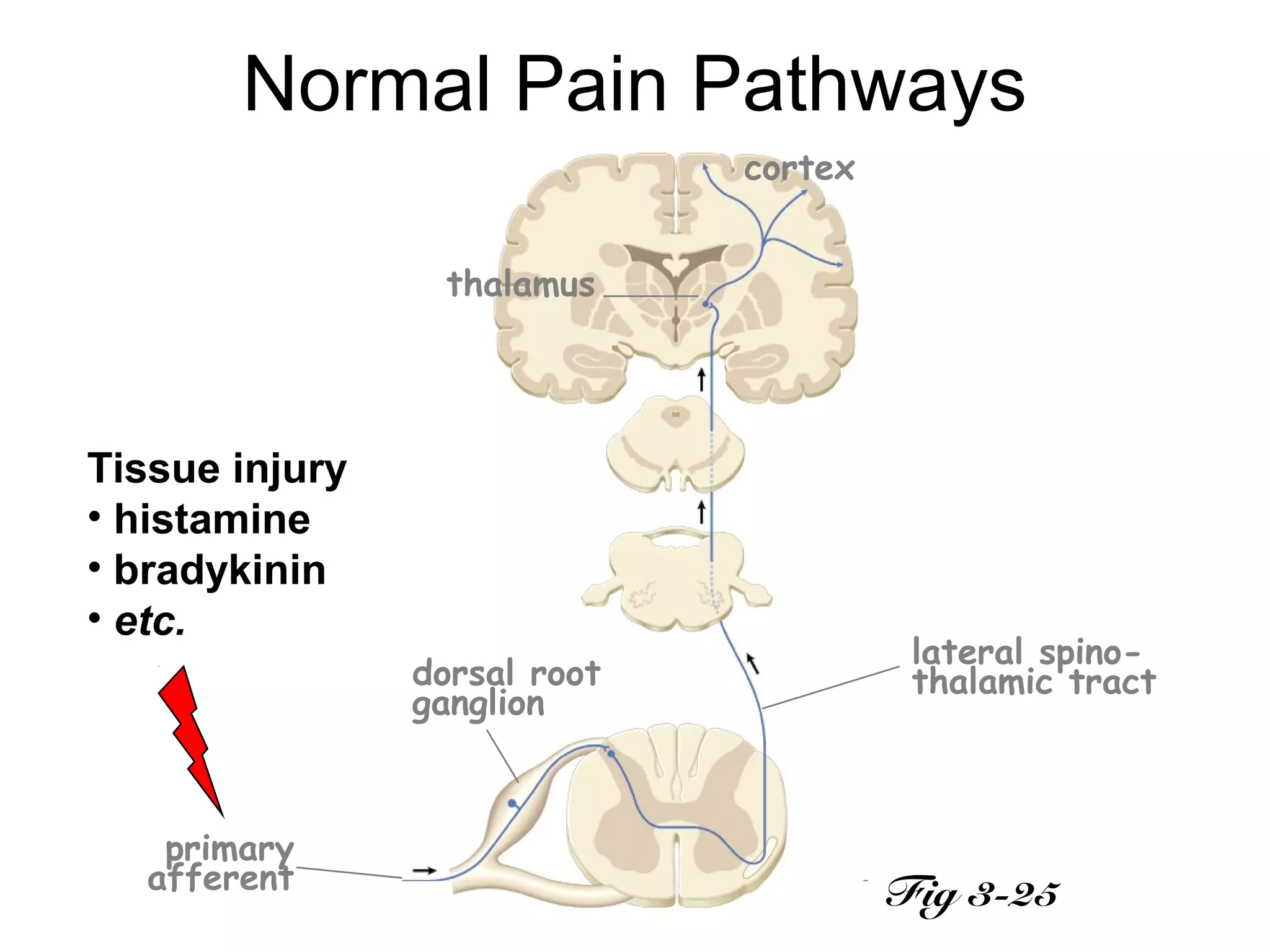 Pain | PPT