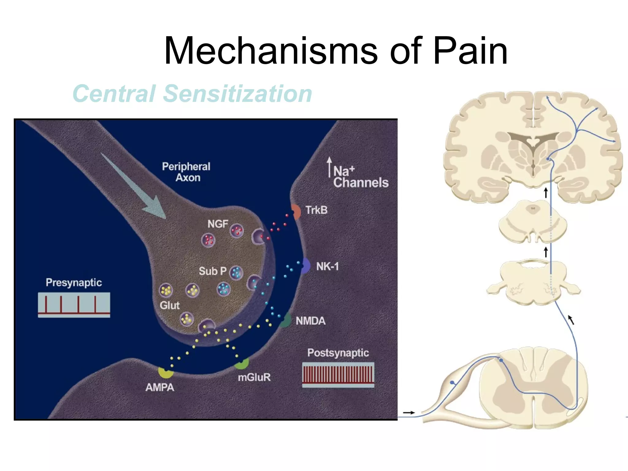 Pain | PPT