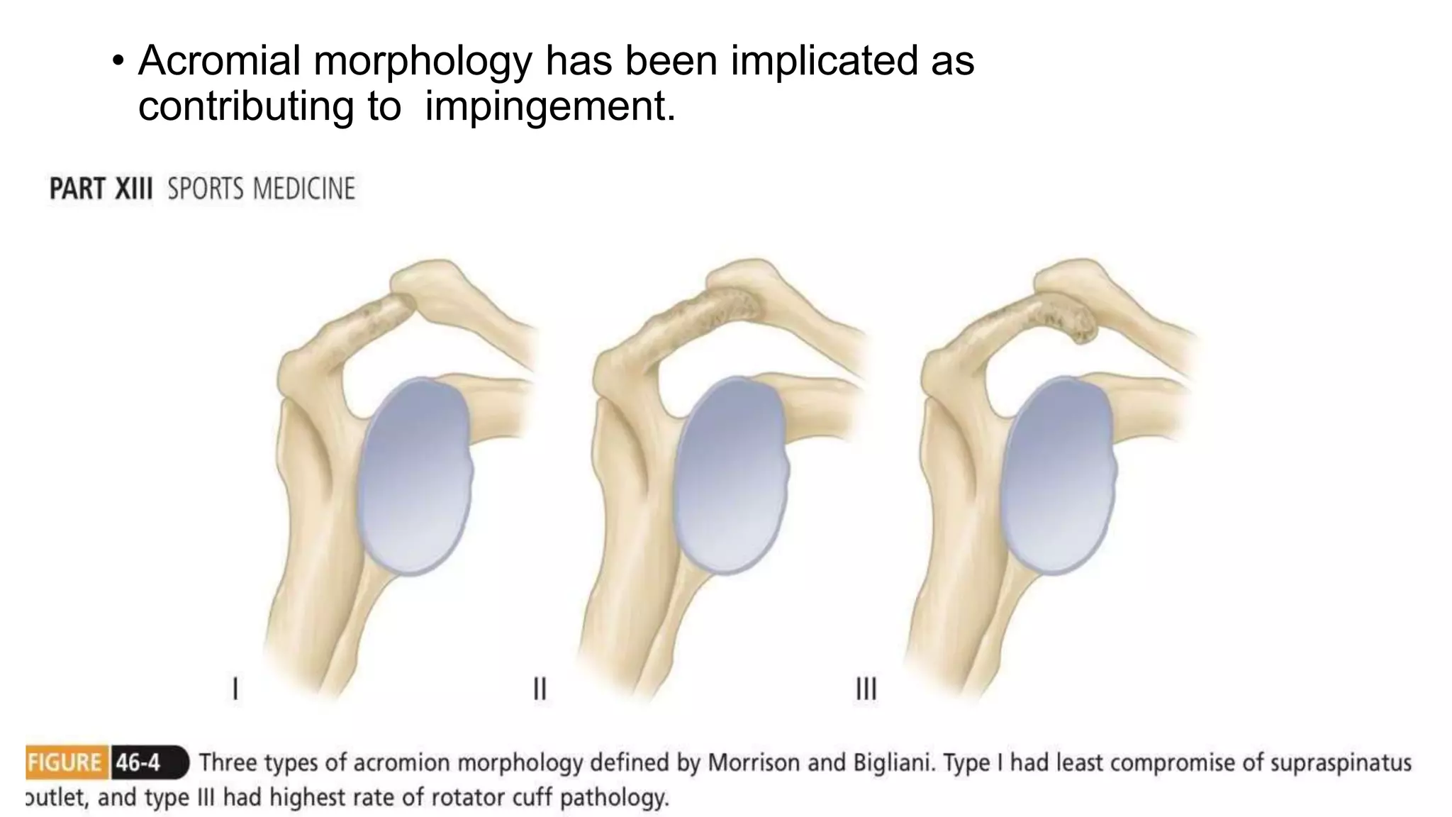 Painful arc syndrome | PPTX