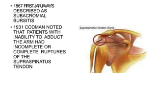 Painful arc syndrome | PPTX