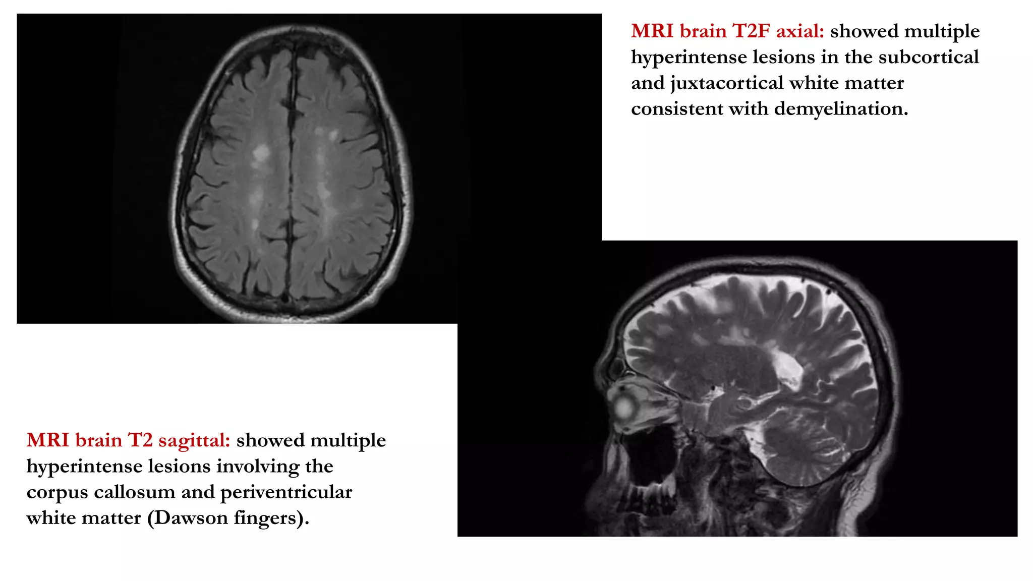 Painful Challenges in Neurology.pptx